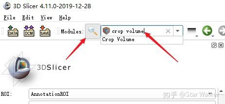 3D Slicer——选择感兴趣区，输出为DICOM序列 - 知乎