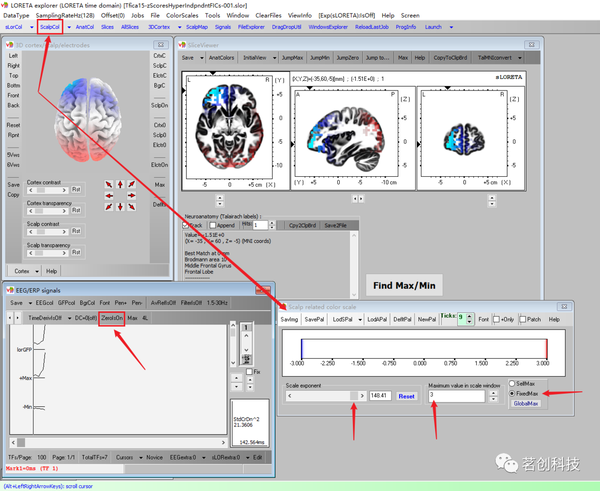 基于LORETA的EEG静息态脑网络分析 - 知乎