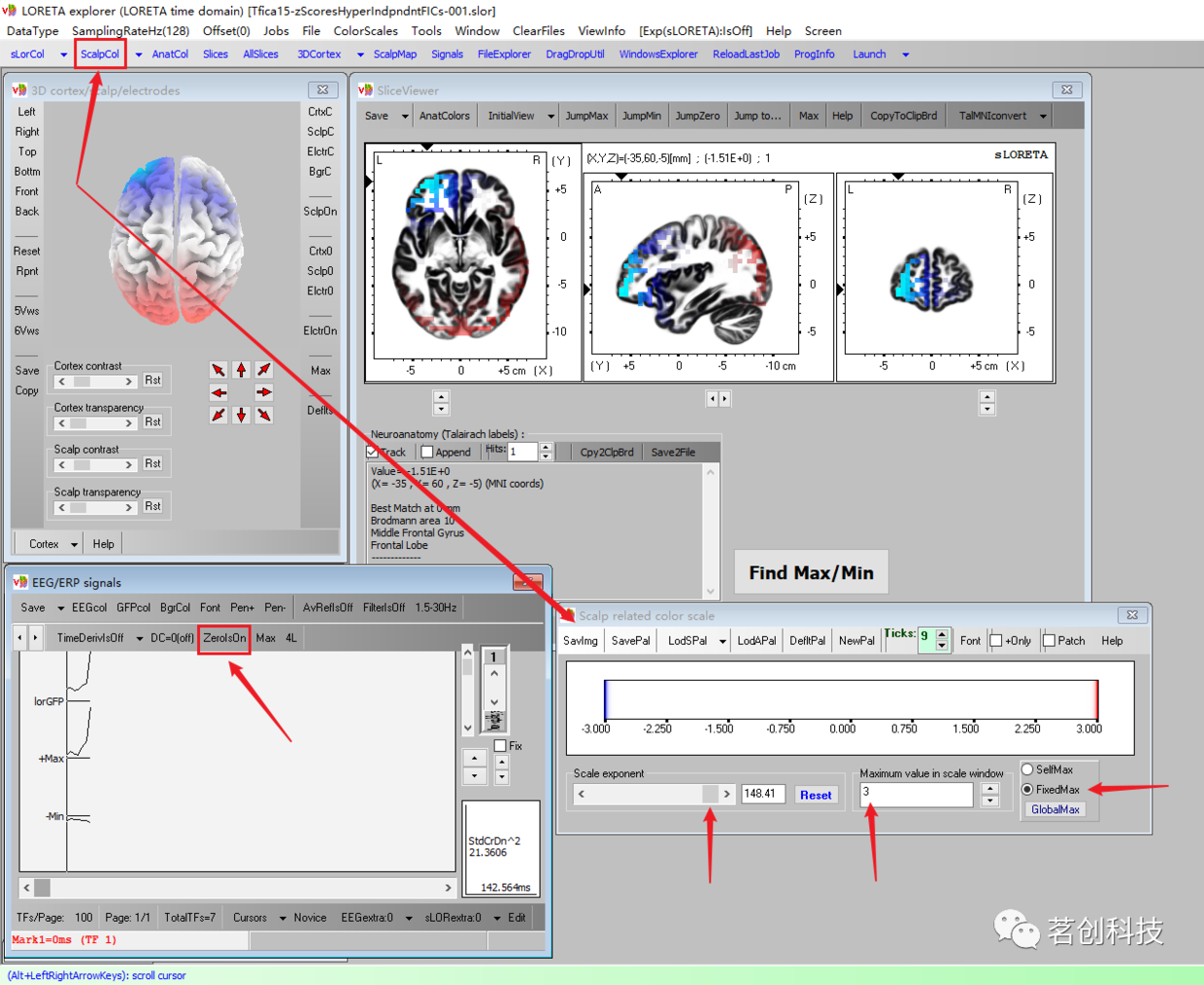 基于LORETA的EEG静息态脑网络分析 - 知乎