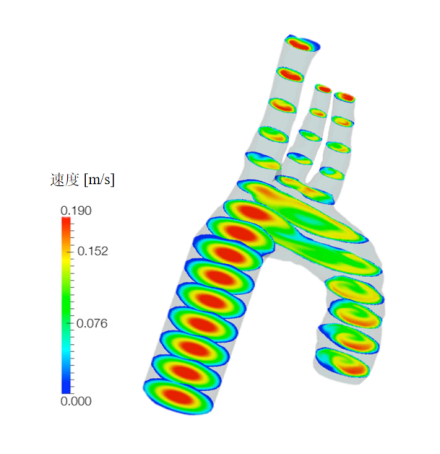 【EDF开源CAE】code_saturne分析人体动脉血液流动 - 知乎