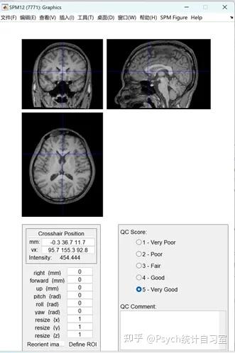 基于DPABI的静息态fMRI的数据预处理流程 - 知乎