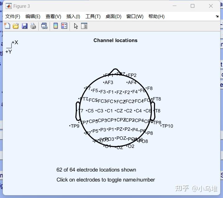 Matlab医学信号处理1 （eeglab保姆级别教程） - 知乎