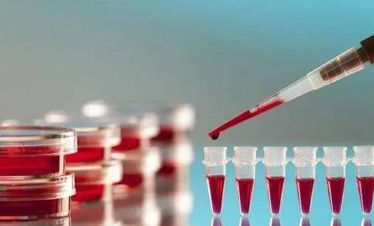 血型室的奥秘 | 善于隐身的Kidd血型抗体 - 知乎