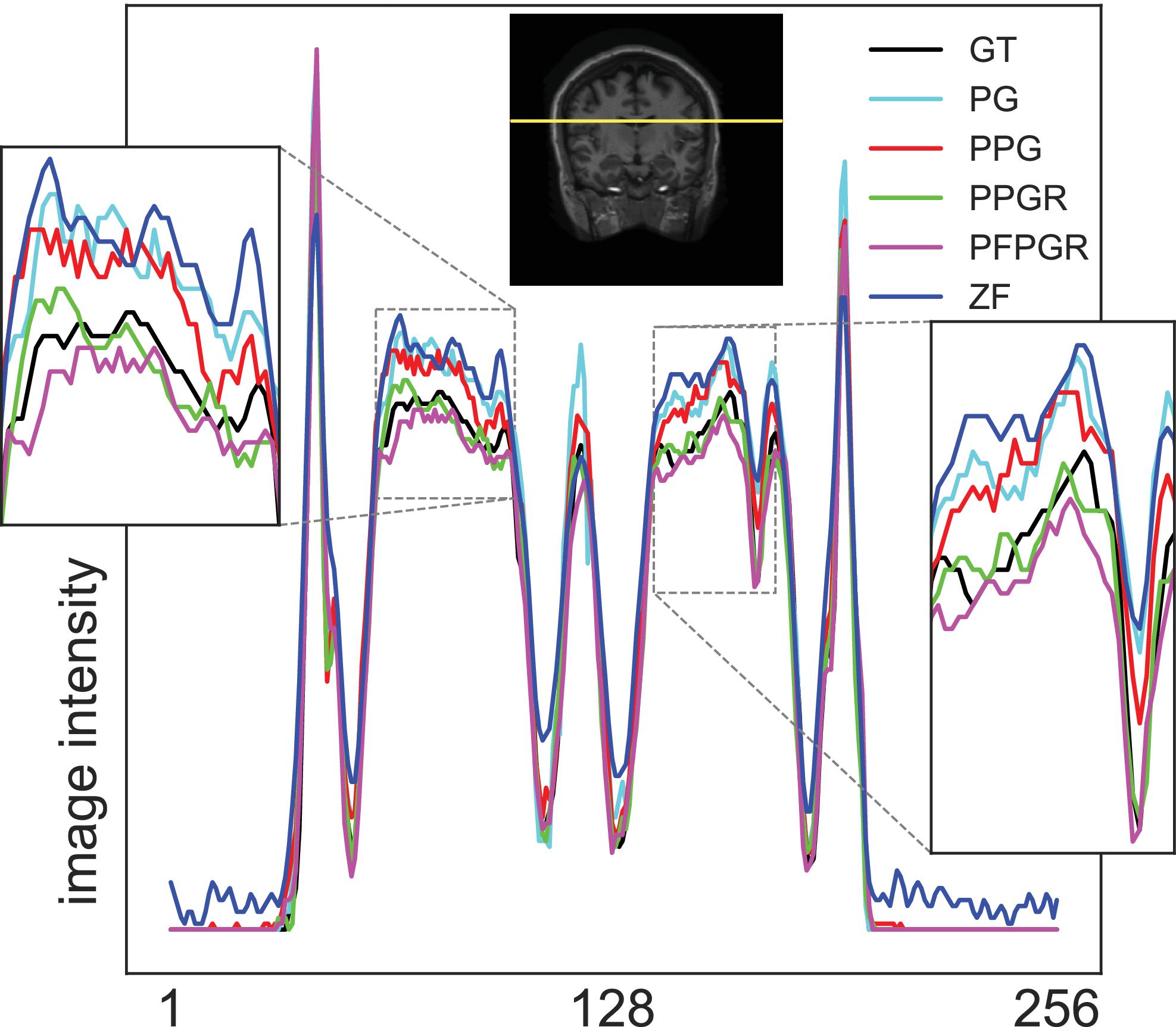 DAGAN: DAGAN for Fast CS-MRI Reconstruction - 知乎