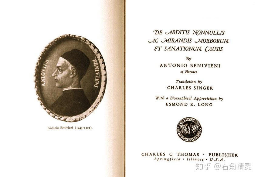 泌尿传奇：尿路结石的历史154 - 知乎