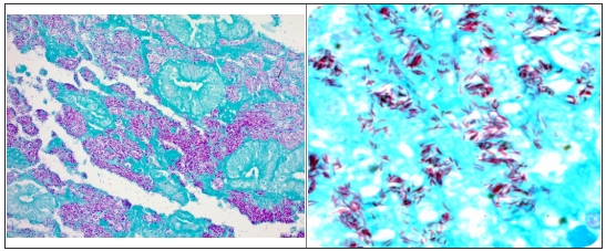 抗酸染色（Acid Fast Bacteria (AFB) Stain）原理和用途 - 知乎
