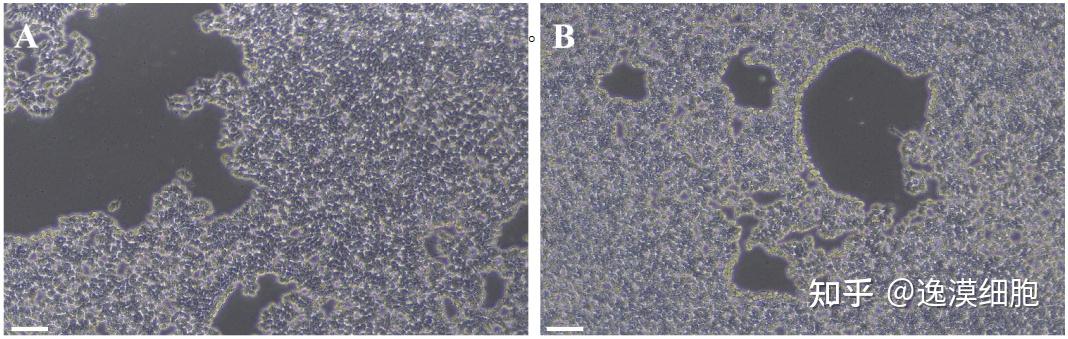 hiPSC人多能干细胞培养经验分享 - 知乎