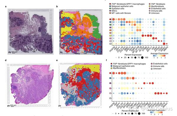 关于10X空间转录组质控分析的讨论 - 知乎