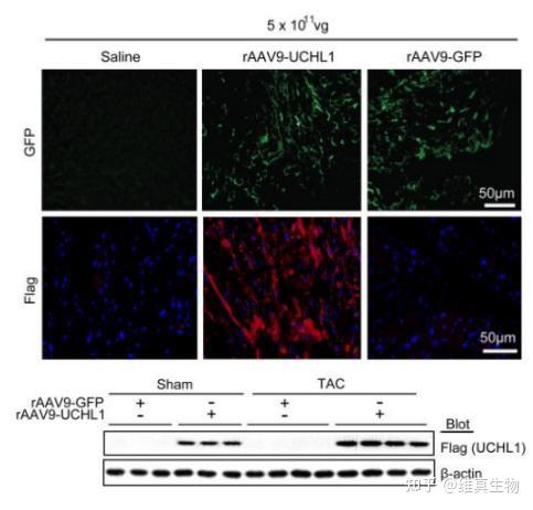 案例分享｜盘点AAV在心脏研究中的应用实例 - 知乎