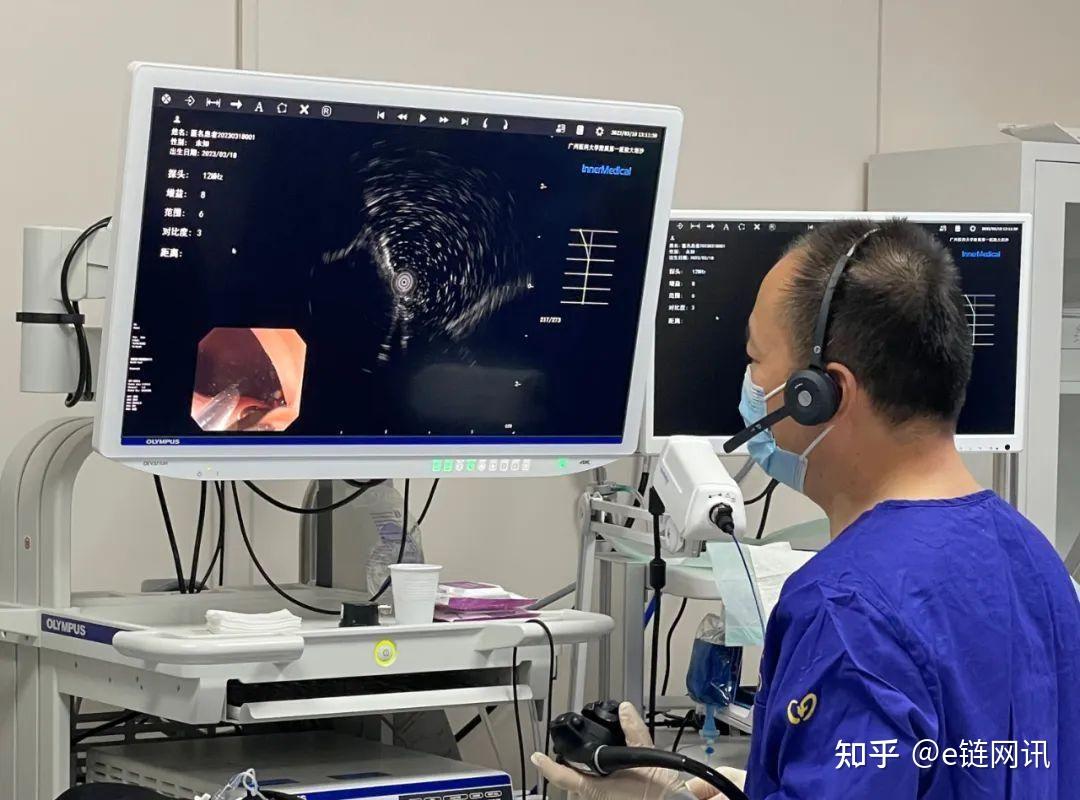 精准微创 共筑健康——超声小探头亮相消化内镜诊疗论坛-手术演示 - 知乎