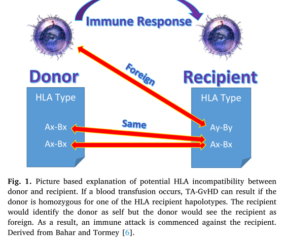 输血相关移植物抗宿主病（TA-GvHD）能否仅通过减少白细胞来预防？ - 知乎