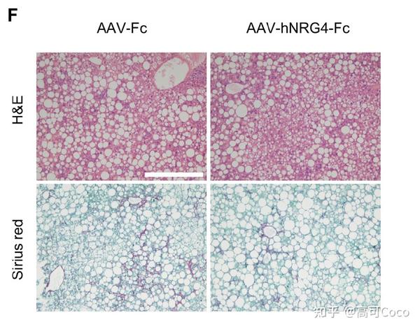 001-文献分析分享：普通转录组+单细胞分析-巨噬细胞分群 （3） - 知乎