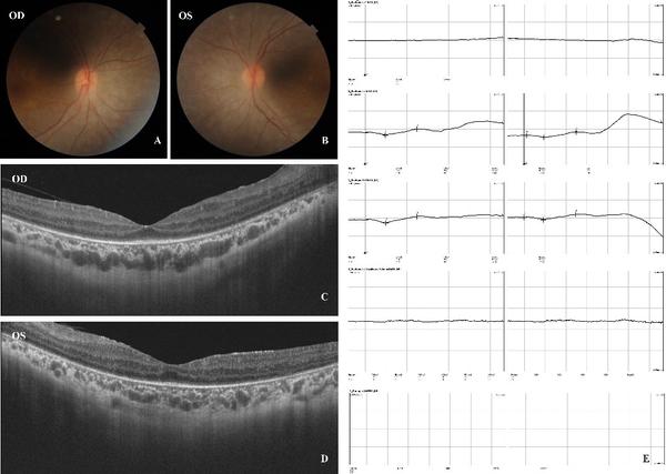 蒋纺走跃动货——肉粒怕盲屈网苦塑ROSAH枫襟石垂兜2菇 - 知乎