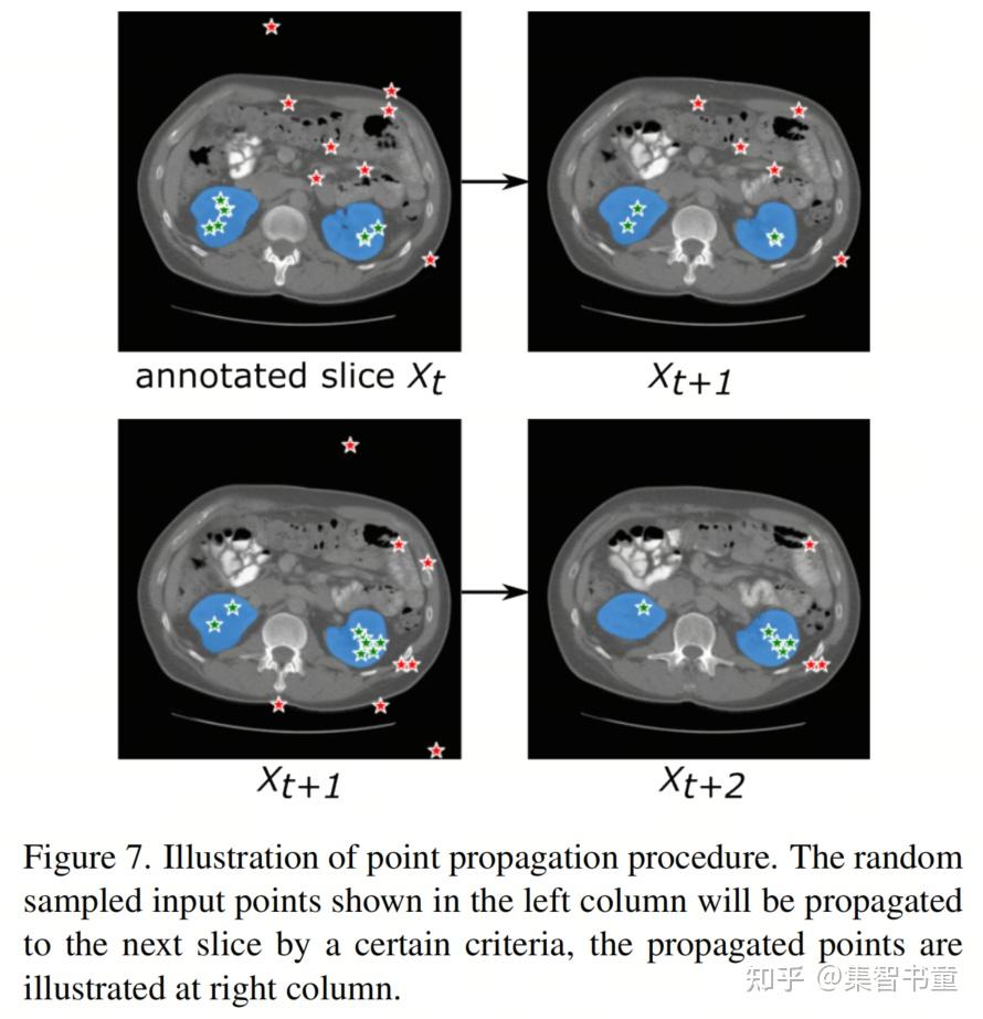 SAM-Med | 英伟达基于SAM提出医学图像标注效率神器 - 知乎