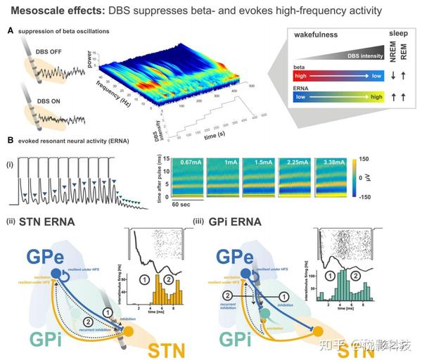 Brain综述：跨时空分辨率的DBS神经生理机制 - 知乎