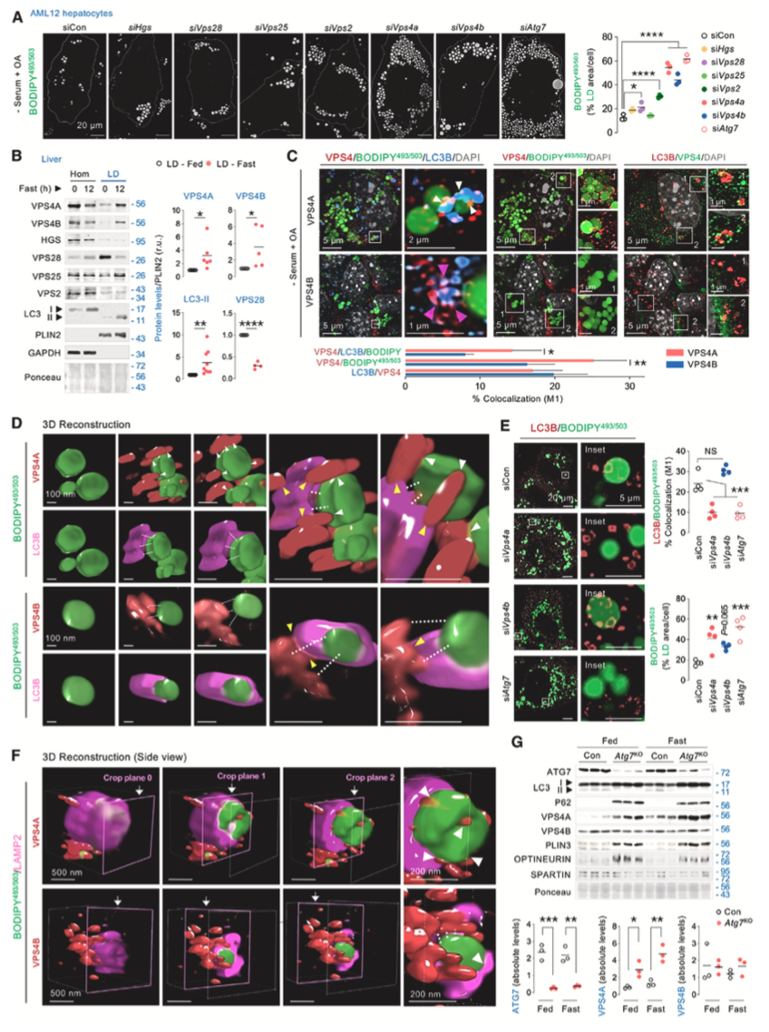 Molecular Cell丨VPS4A 是小鼠和人类脂噬的选择性受体 - 知乎