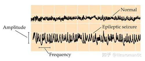 神经振荡（Neural oscillation）：神经活动的节奏和韵律 - 知乎