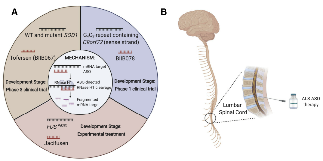 Neuron综述｜肌萎缩侧索硬化症（ALS）的发病机制和基因治疗方案 - 知乎