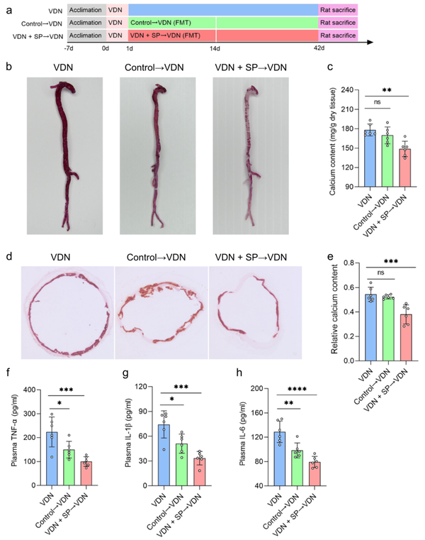 Microbiome｜源于肠道微生物群的“秘密武器”—短链脂肪酸，降低心血管疾病发病率有奇招？ - 知乎