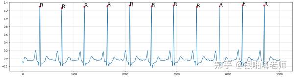 PTB-XL心电随机分类 - 知乎