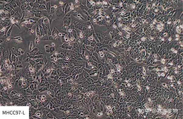 细胞学堂|人肝癌细胞系 - 知乎
