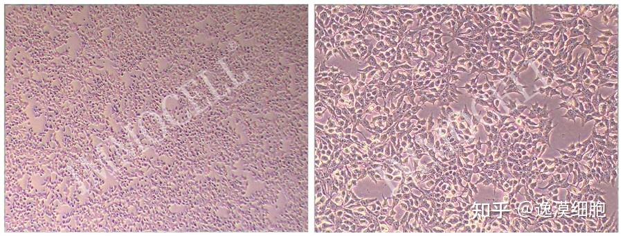 266-6小鼠胰腺腺泡癌细胞培养 - 知乎
