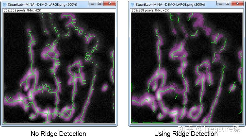 ImageJ实用技巧——线粒体网络形态分析(插件篇) - 知乎