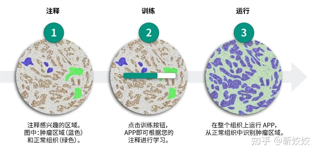 解锁精准医学新纪元：Visiopharm病理分析系统的革命性力量 - 知乎