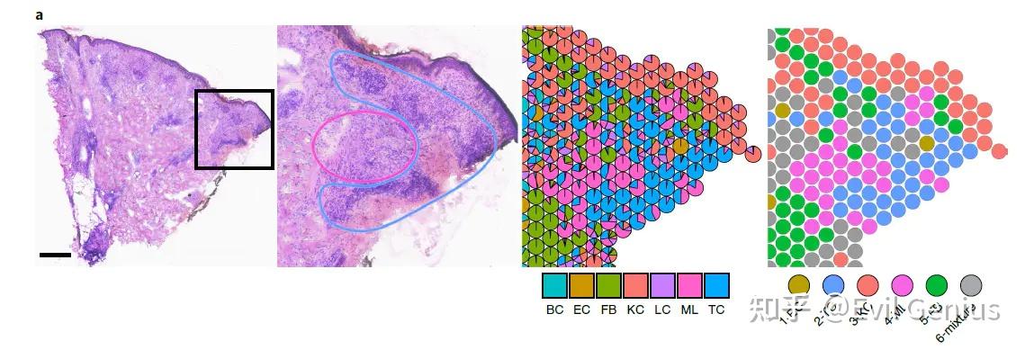 单细胞空间联合分析方法之文献运用篇 - 知乎