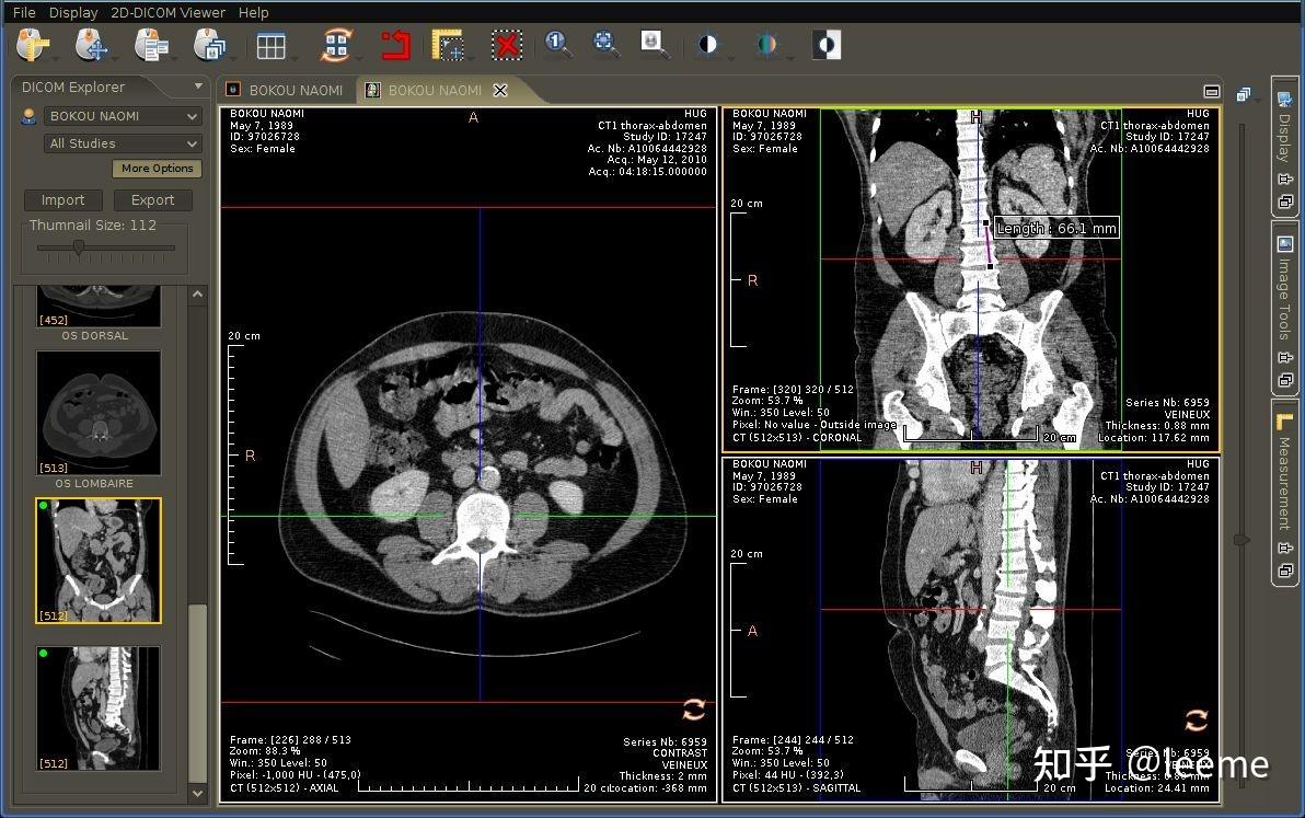 世界著名医疗影像软件介绍 - 知乎