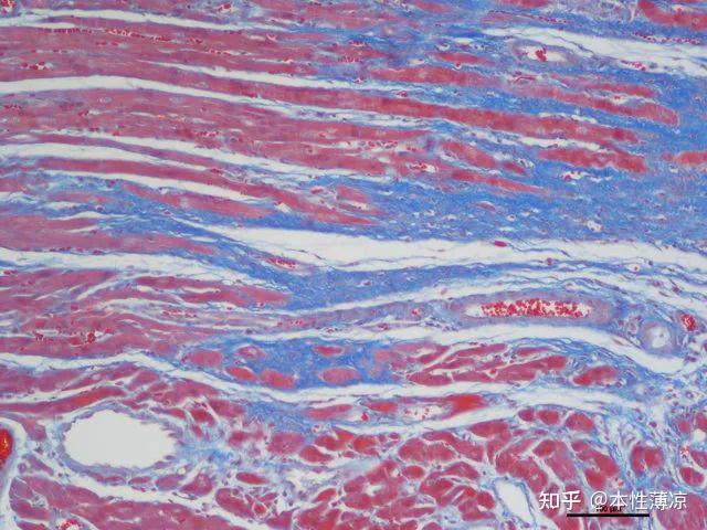 Masson Trichrome染色法（Masson 三色染色，可用于组织切片纤维化观察） - 知乎