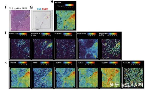 10X空间转录组重点分析合集 - 知乎