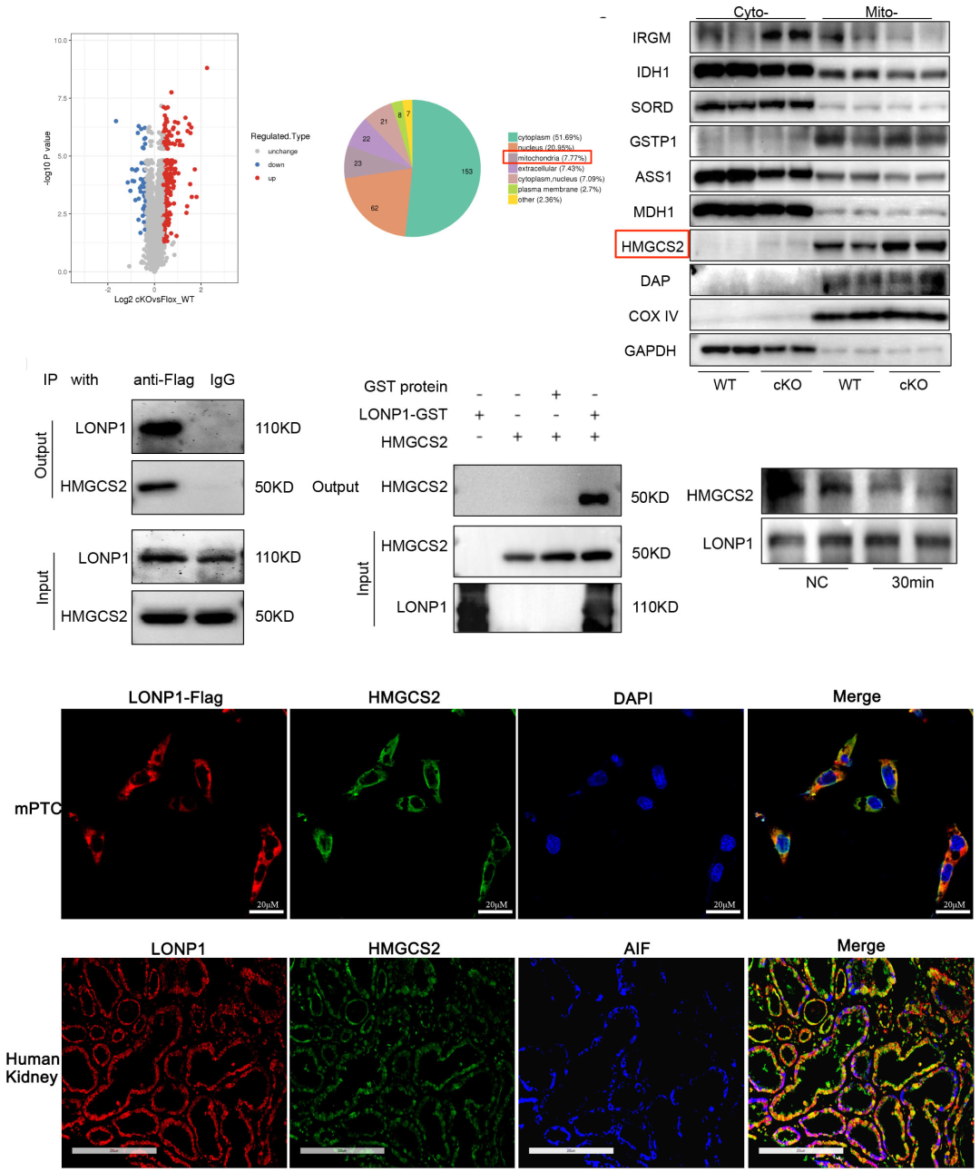 EMBO Mol Med | 南京医科大学张爱华/贾占军教授蛋白质组学发现慢性肾脏疾病的潜在治疗靶点 - 知乎