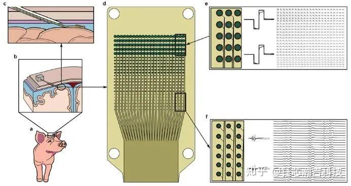 脑机接口厂商Precision获FDA突破性医疗器械认定 - 知乎