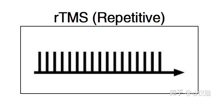 常见TMS刺激协议有哪些？ - 知乎