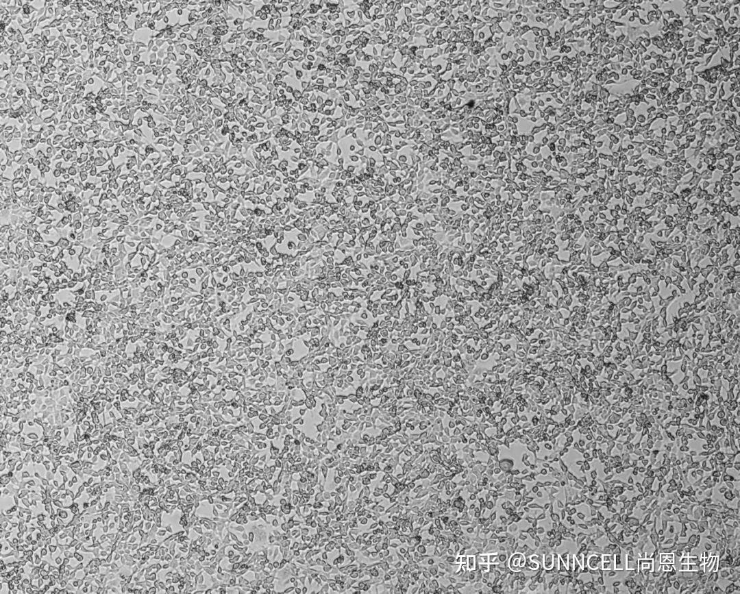 CT26.WT(小鼠结肠癌细胞)培养教程 - 知乎