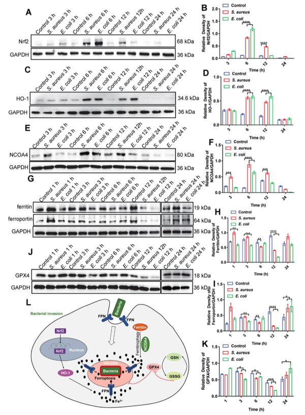 中科院一区TOP Theranostics丨铁死亡的抗菌作用 - 知乎