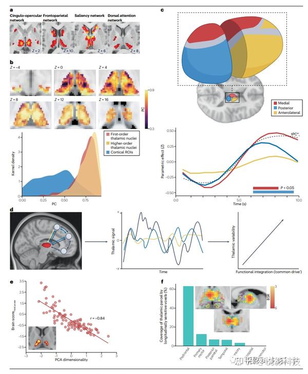 Nature reviews neuroscience:人类丘脑对全脑信息处理的影响 - 知乎