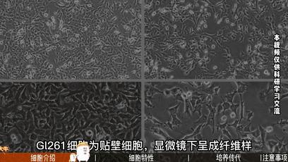 GL261细胞培养，小鼠胶质瘤细胞培养攻略-丰晖生物 - 知乎