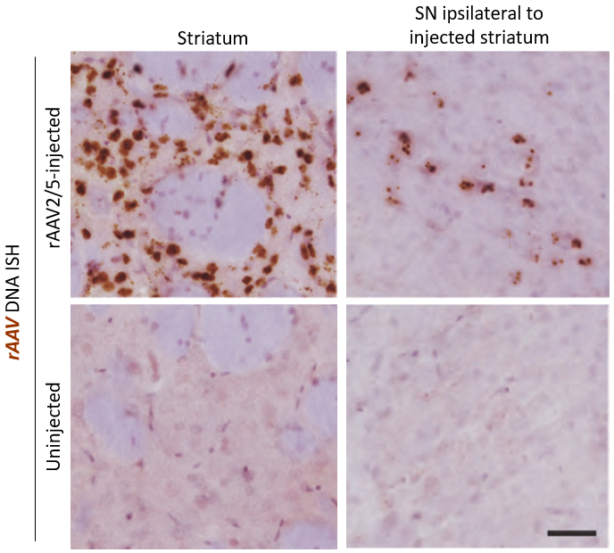 RNAscope 在基因治疗 AAV 载体相关检测中的应用（上） - 知乎