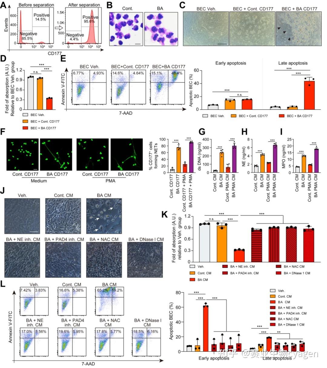 广州医科大学团队揭示CD177+中性粒细胞在胆道闭锁中的作用 - 知乎