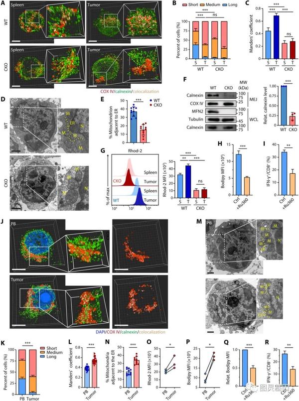 Sci Immu | 中山大学团队发现：线粒体-内质网接触支持肿瘤中的CD8+T细胞代谢适应性和功能 - 知乎