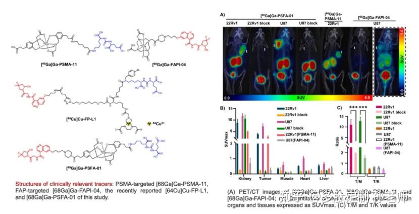 PSMA-FAPI双靶向优势以及临床应用研究 - 知乎