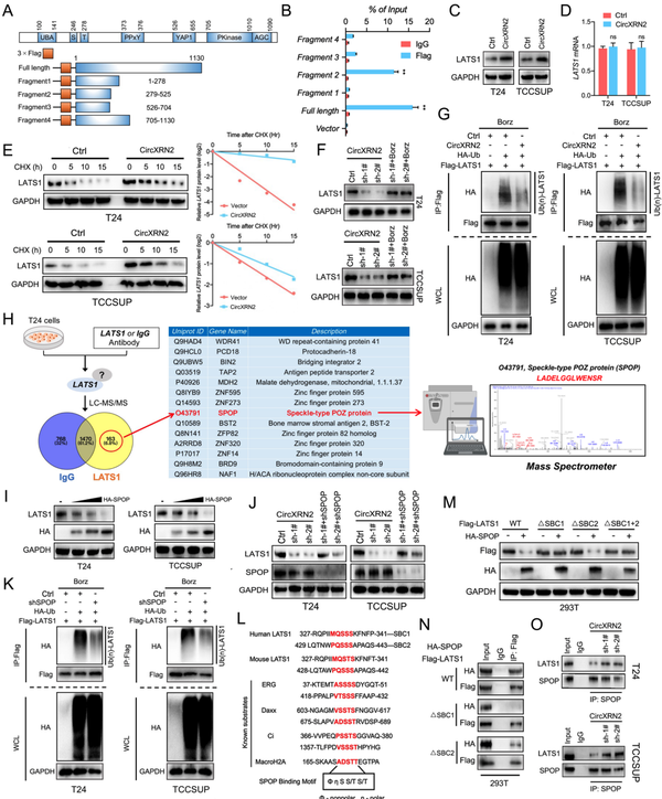Mol. Cancer|浙大一院揭示H3K18乳酸化介导的膀胱癌进展调控机制 - 知乎