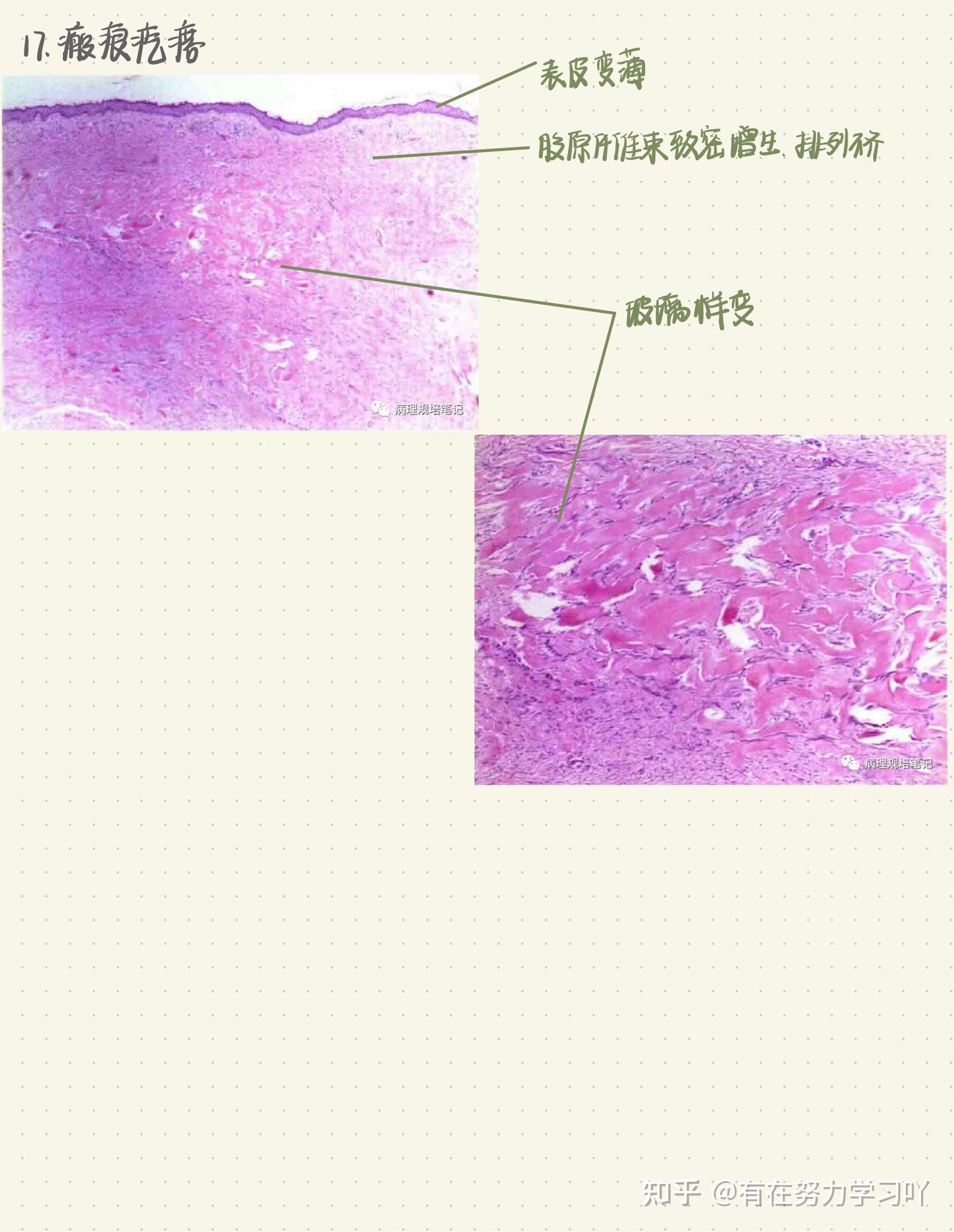 皮肤病理 - 知乎