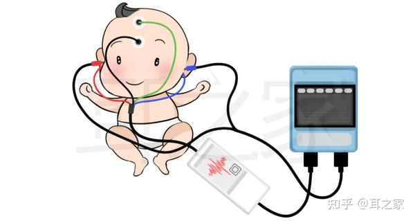 睡着做的那项听力测试（ABR），结果怎么看？ - 知乎