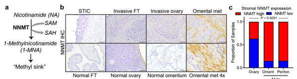 文献解读 | Nature 空间蛋白揭示NNMT是癌症相关成纤维细胞的主要代谢调节因子 - 知乎