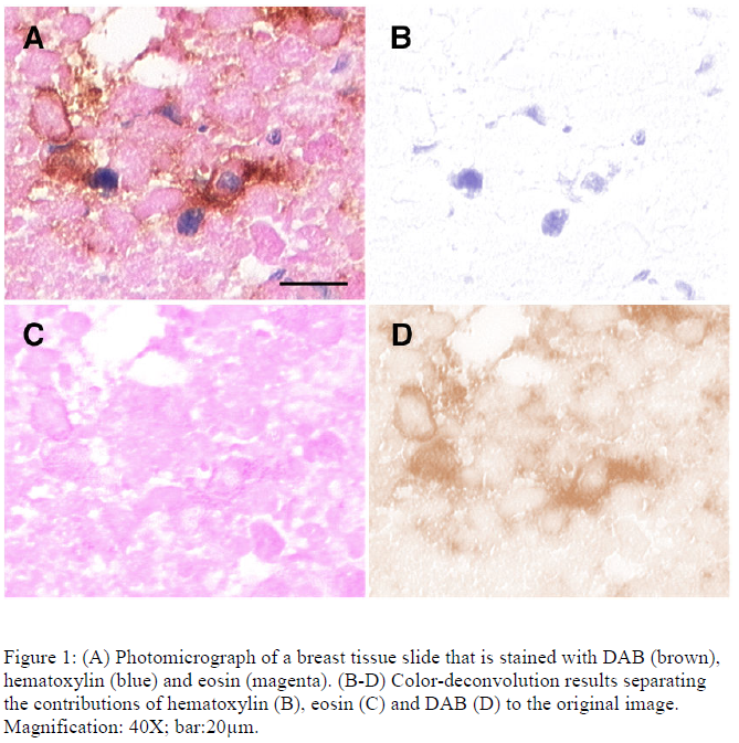 Color Deconvolution - 知乎