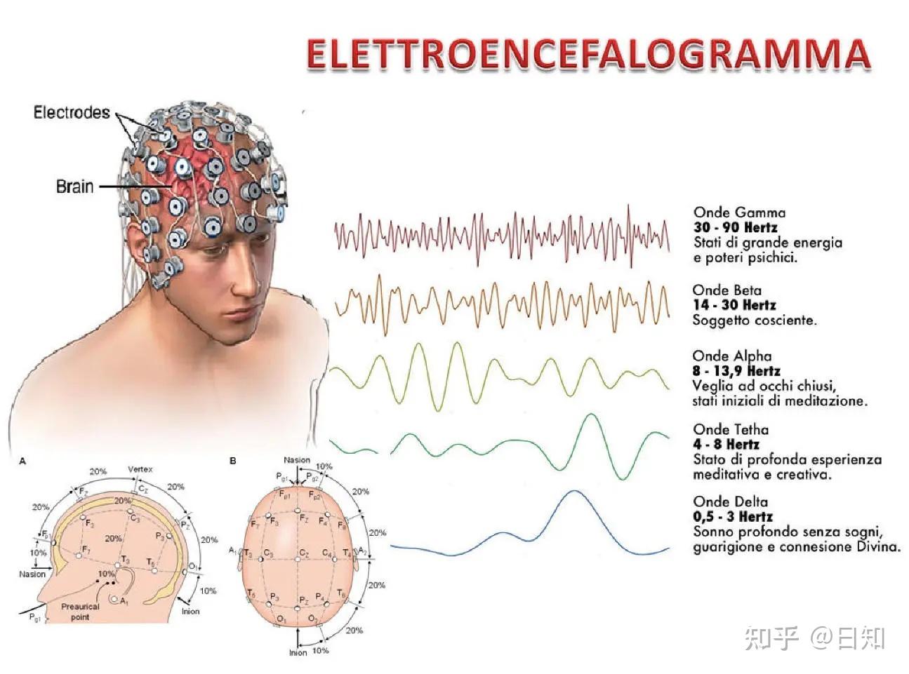 TorchEEG —— 基于 PyTorch 的模块化脑电分析 - 知乎