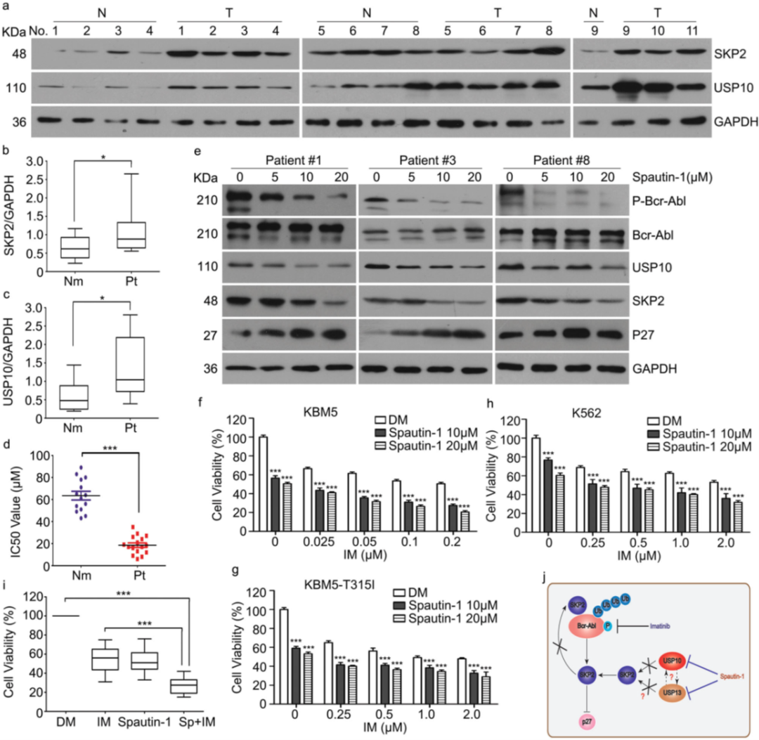 USP10通过稳定慢性粒细胞白血病中的SKP2来调节SKP2/Bcr-Abl轴 - 知乎